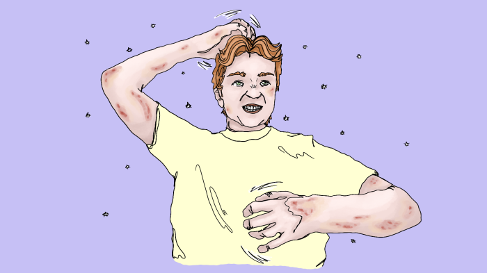 En overlevelsesguide til skabb