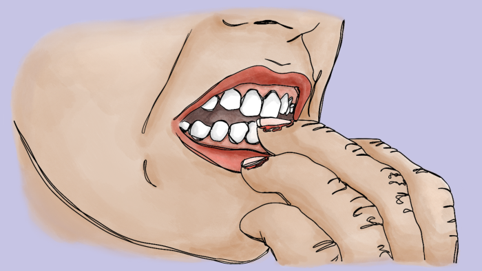 Slutte å bite negler